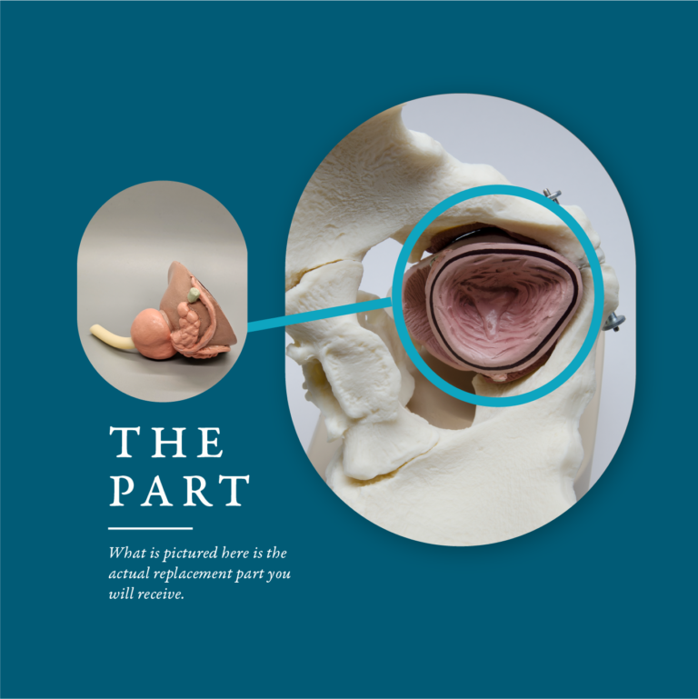 Bladder Replacement Part for ESP Male Model - CMT Medical
